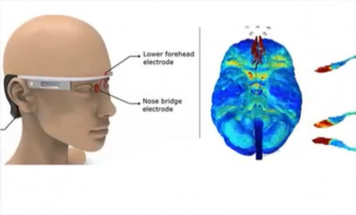 Scientists Invented a Wearable Device That Can Prevent Alzheimer’s ...