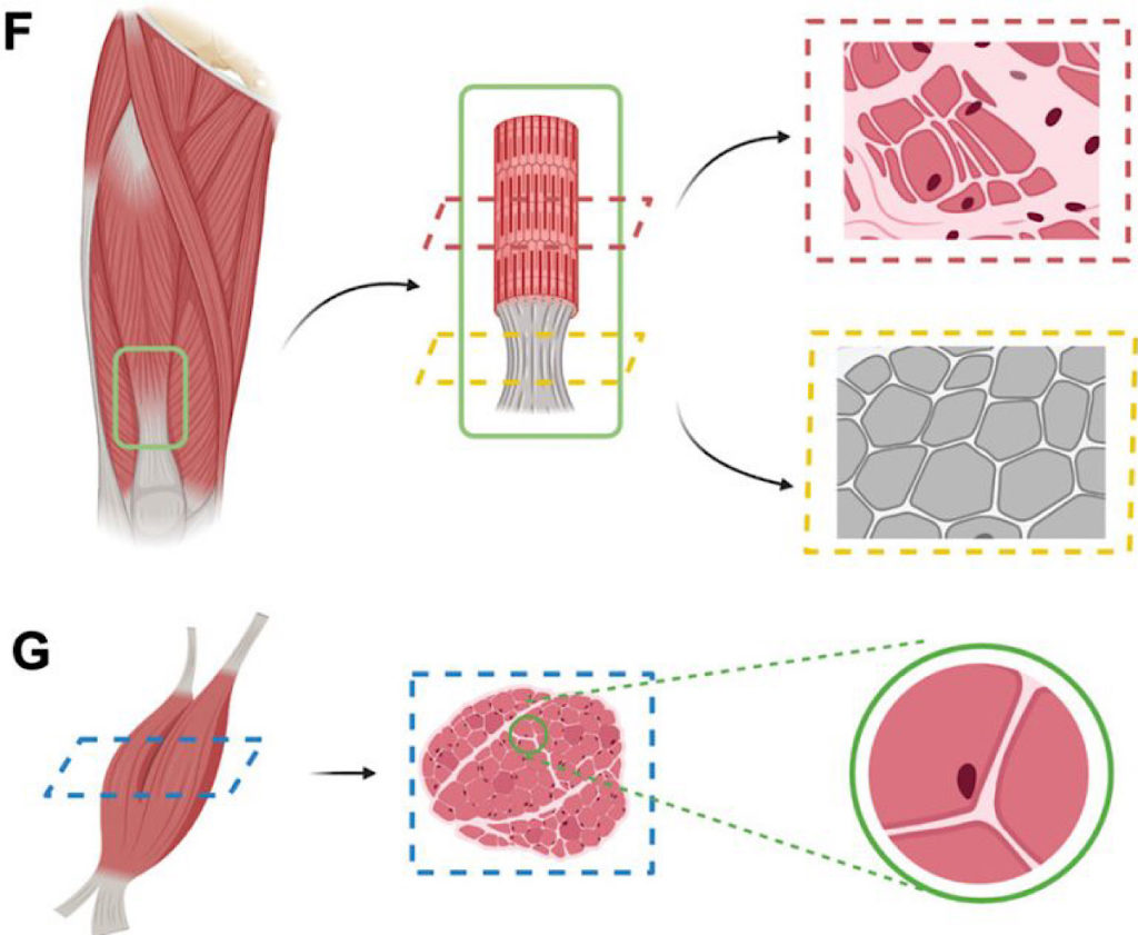 LIVE HUMAN TENDON 3D PRINTED BY SCIENTISTS WITH NEW ‘CRYO-BIOPRINTING ...