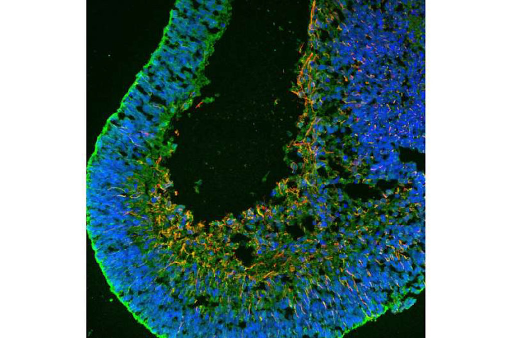 Cell fusion ‘awakens’ regenerative potential of human retina – Impact Lab