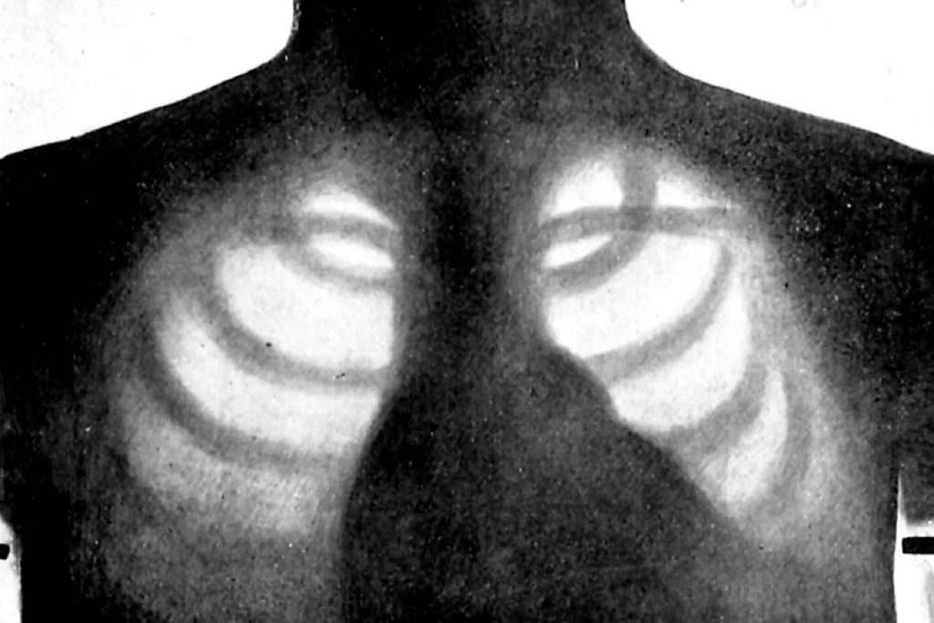 First Autonomous X Ray Analyzing Ai Is Cleared In The Eu Impact Lab