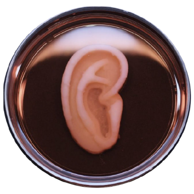 3DBIO CONDUCTS SUCCESSFUL HUMAN EAR RECONSTRUCTION WITH 3D BIOPRINTED ...