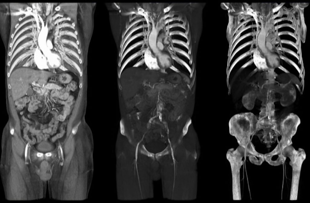 The AI Vision System Set to Revolutionize Whole Body Scans – Impact Lab