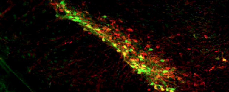 Unveiling the Diversity of Dopamine Neurons: New Insights into Brain ...
