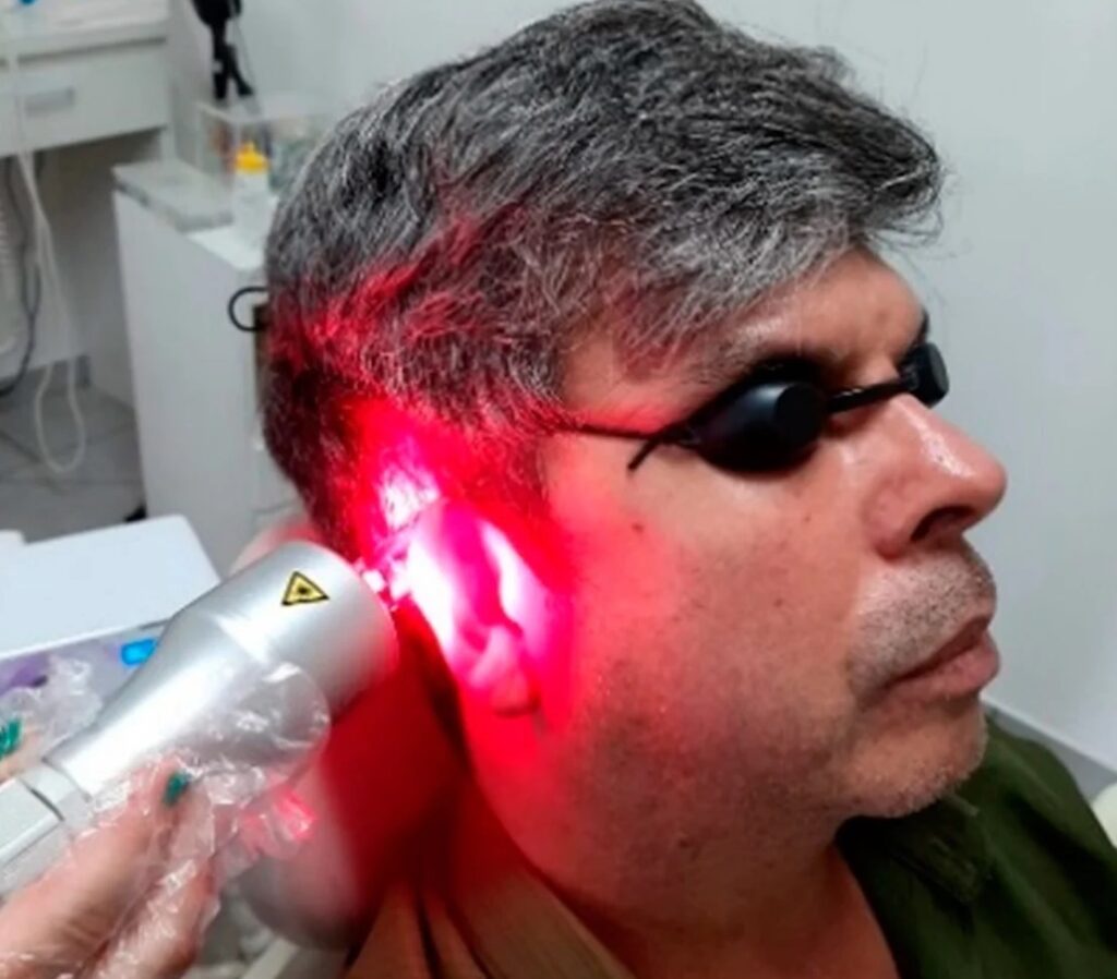 Revolutionizing Tinnitus Treatment: Laser Therapy Breakthrough Unveils ...