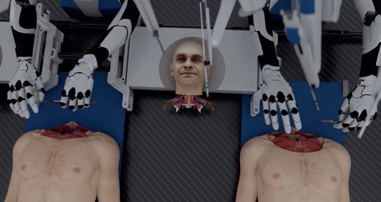 BrainBridge Unveils Revolutionary Head Transplant System – Impact Lab