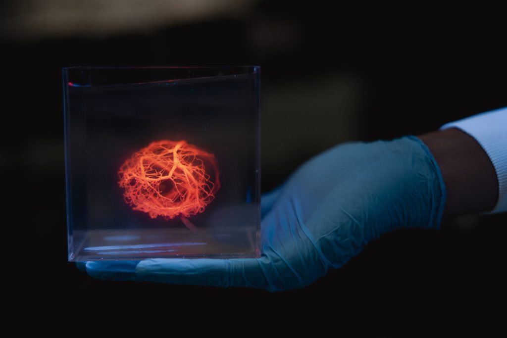 Stanford Breakthrough Speeds Up Design and 3D Printing of Vascular ...