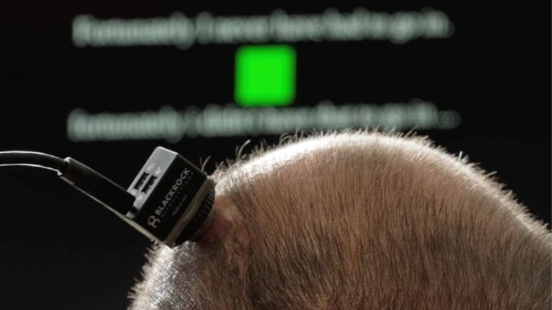 Breakthrough Brain-Computer Interface Restores Real-Time Speech for ALS ...