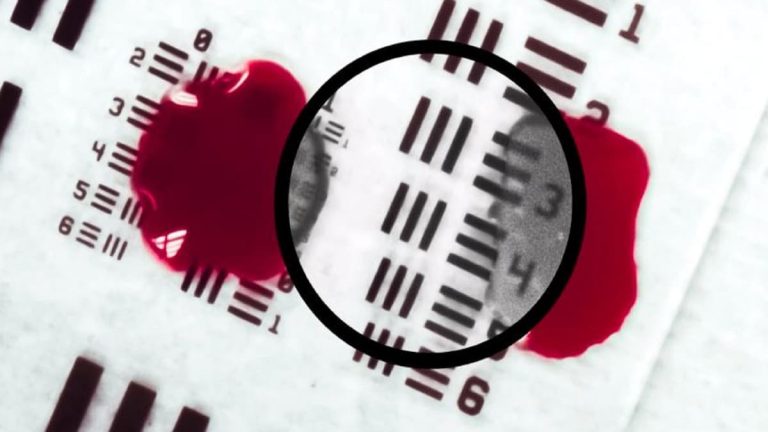 HemoLucence: Breakthrough Imaging Tech Promises Surgeons a Clear View ...